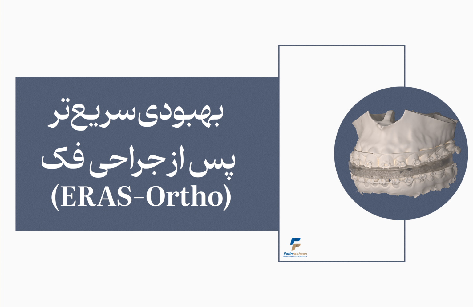 🇬🇧 Enhanced Recovery After Orthognathic Surgery (ERAS-Ortho): A ...